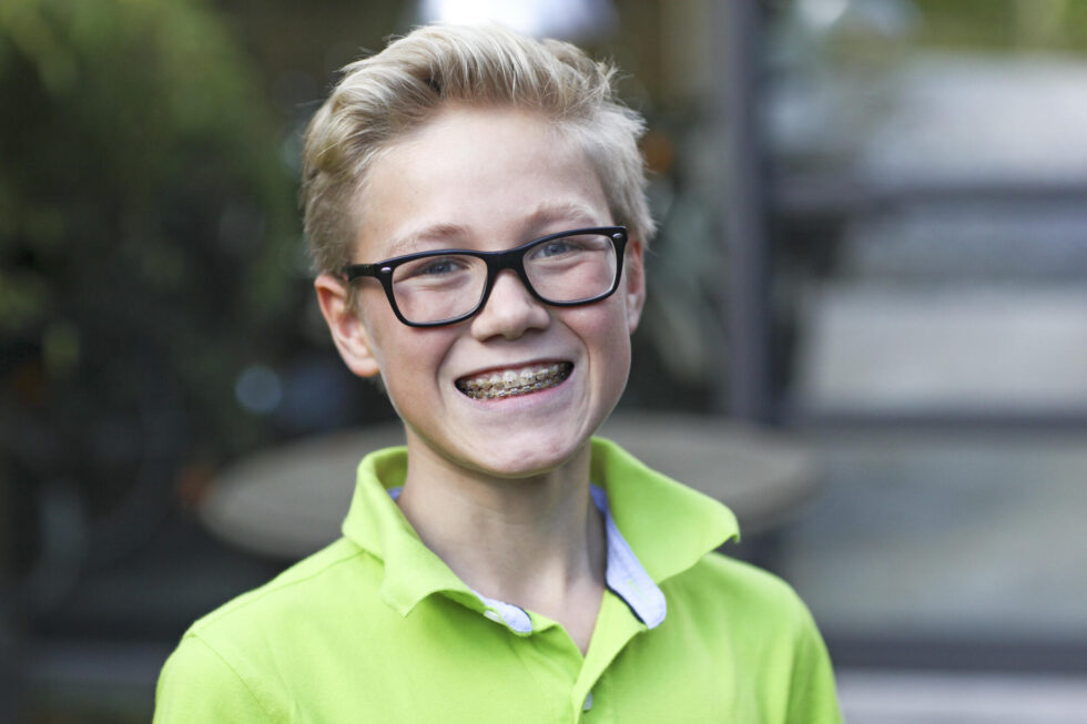 How Long Do Braces Take? A Complete Timeline Guide